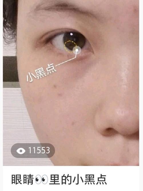 黑点点怎么去除截图