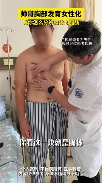 脂肪胸和雌化胸怎么辨别图标