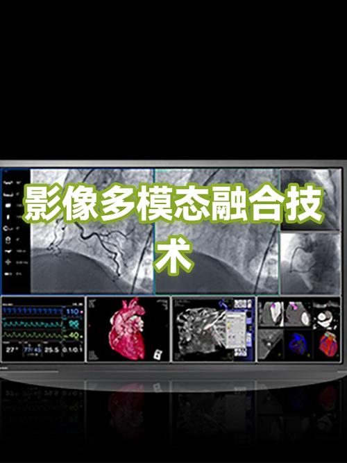 如何将自己录音放到照片图标