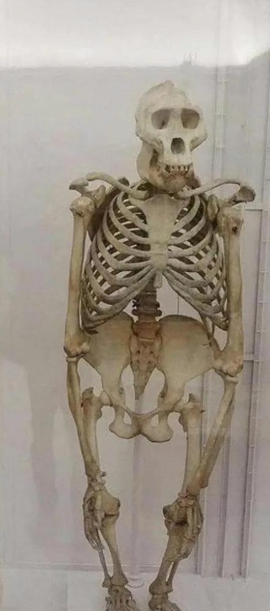 胖子的骨架会比瘦子大吗