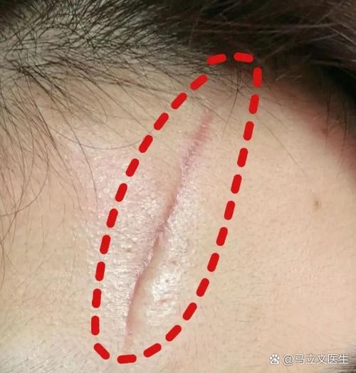 吴邪手臂17道疤被小哥发现文图标