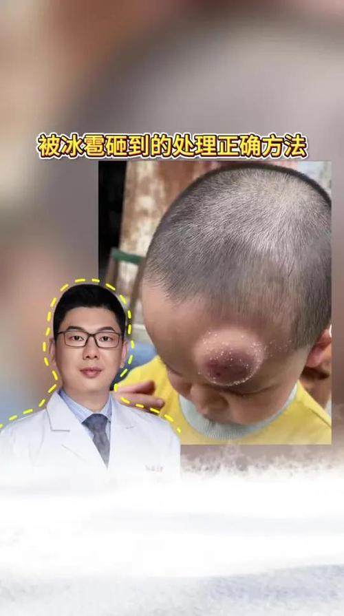 砸到头需要冰块图标