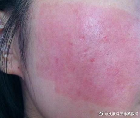 手机屏幕有红色斑块图片图标