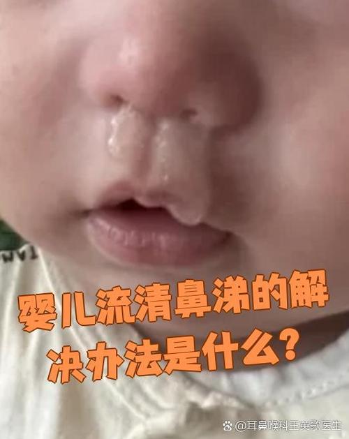 一招停止流清鼻涕图标