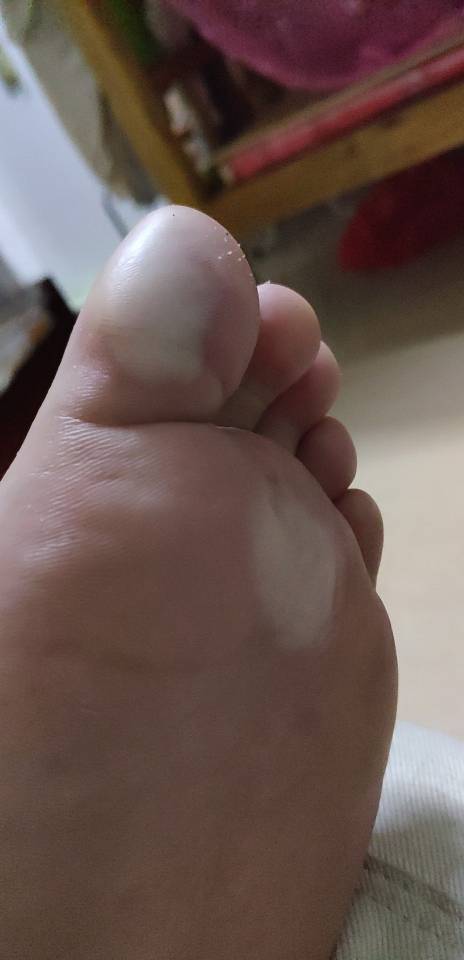 脚大拇指有一道白竖纹图标