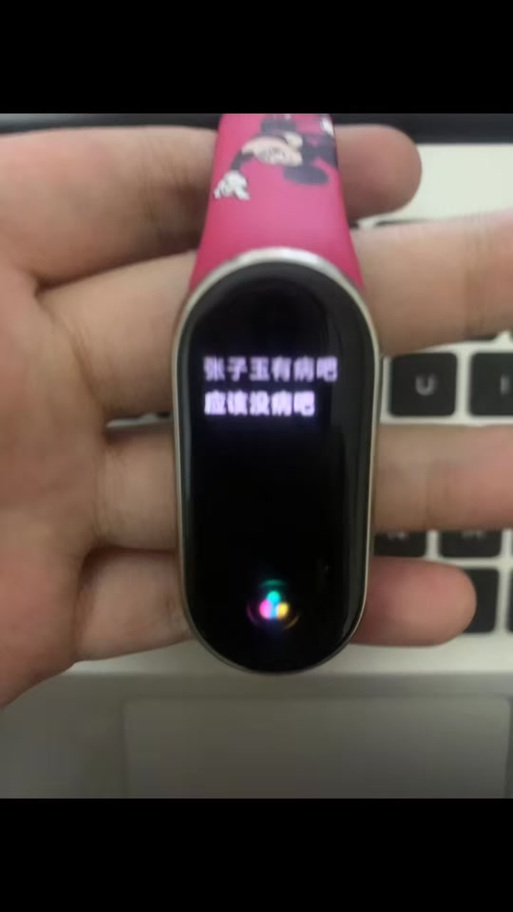 小米手环装反了怎么办截图