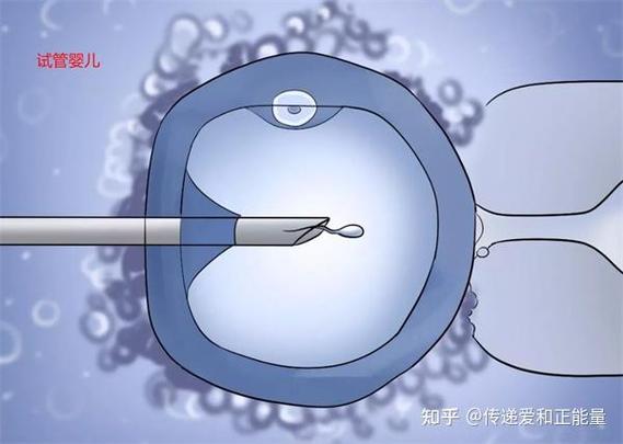输卵管堵塞可以做试管婴儿吗图标