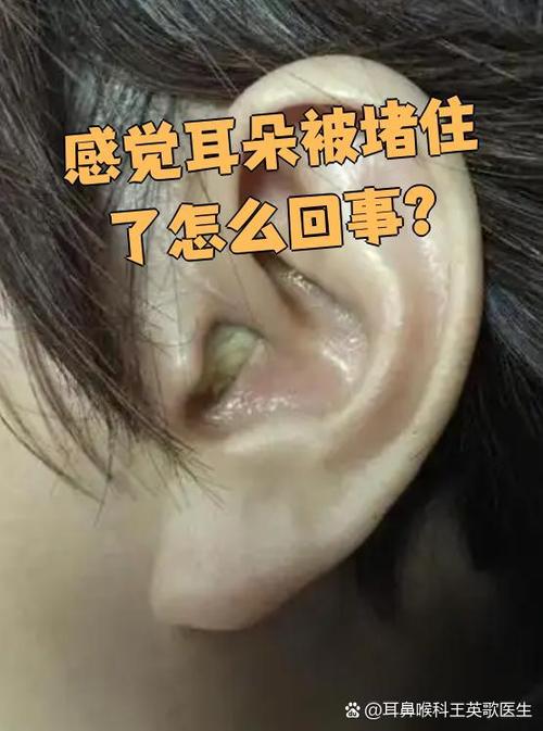 耳朵闷闷的堵住的感觉图标