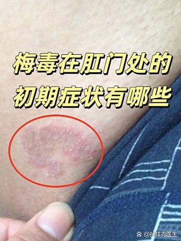 梅毒咨询医生免费咨询图标
