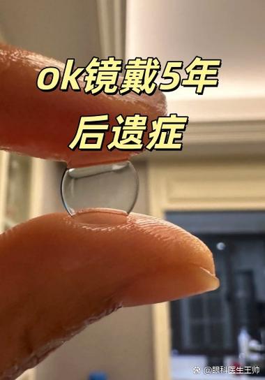 ok镜戴5年后遗症图标