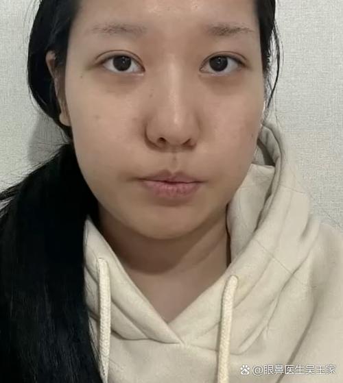 27岁脸部状态截图
