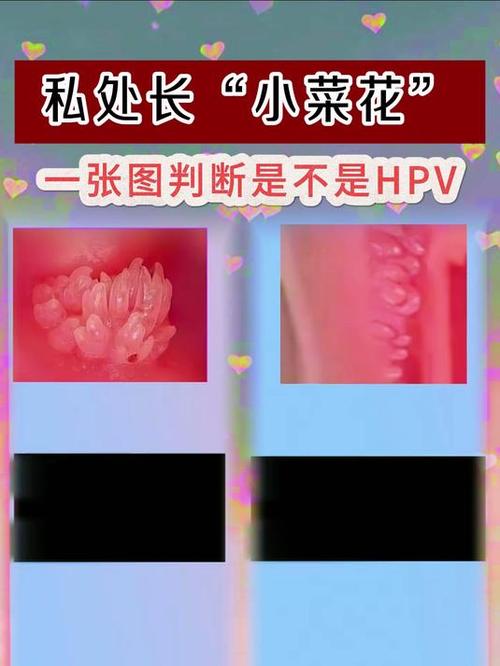 小菜花口子