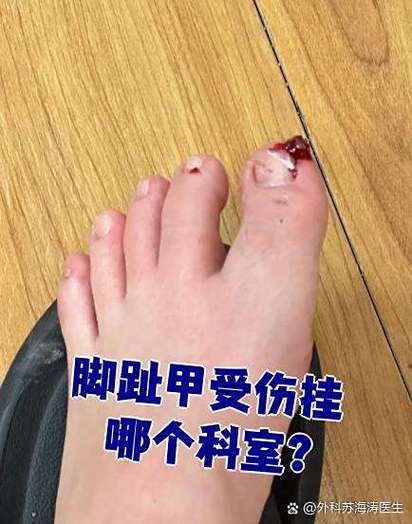 甲沟炎去医院挂什么科