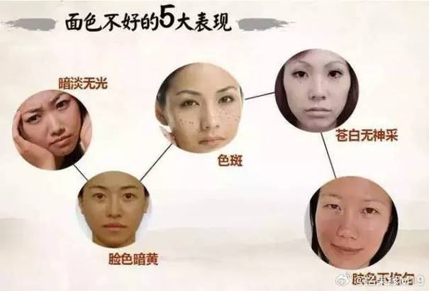 肾虚会脸色发黄吗图标