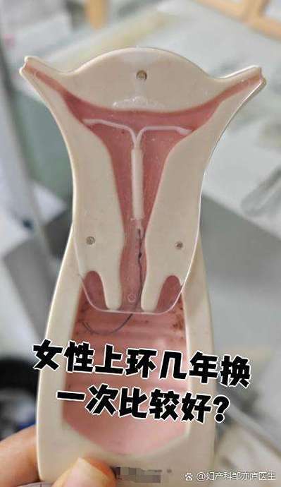 现在女性带什么环最安全截图
