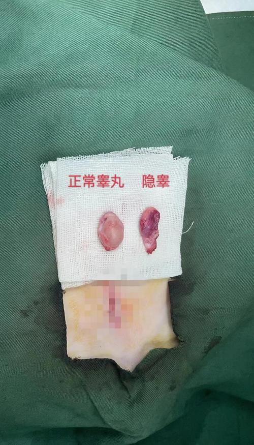 初三男生睾丸图标