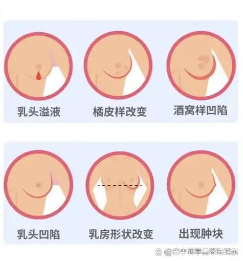 怎样判断是不是肿瘤热图标