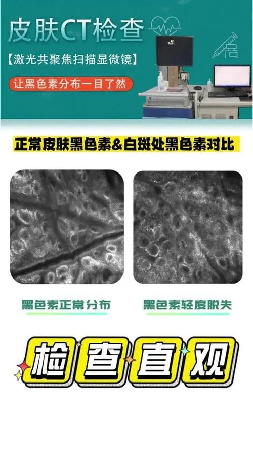 换手机屏出现白斑是什么原因图标