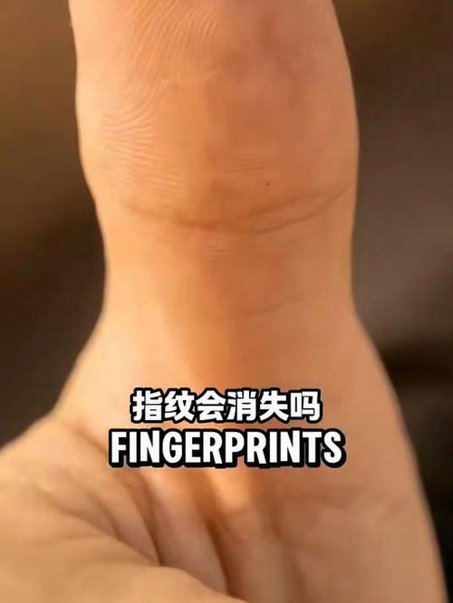 皮肤上能留下指纹吗图标