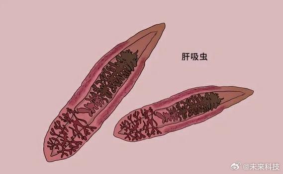 寄生虫怎么进入人体图标