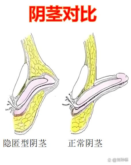 和平精英地图不显示脚步图标
