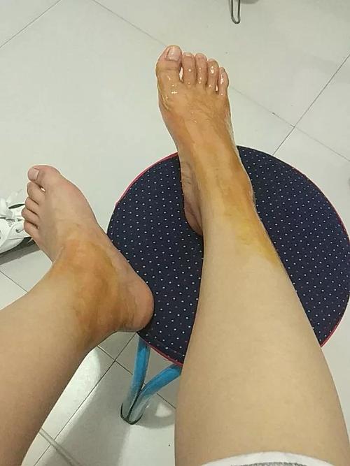 银行卡被热水烫变形了还能用吗图标