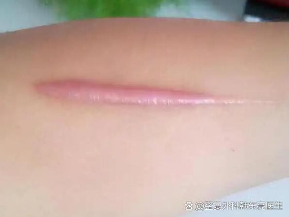 脸上有疤痕怎么消除最快最有效图标