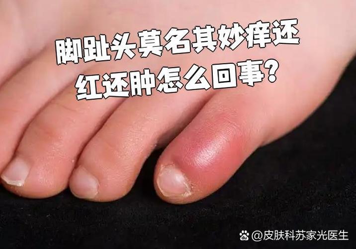 脚趾一挠就痒的难受截图