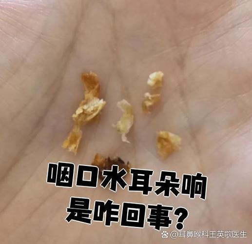 耳朵里呼隆呼隆的响是怎么回事图标