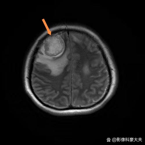 pack CT是什么图标