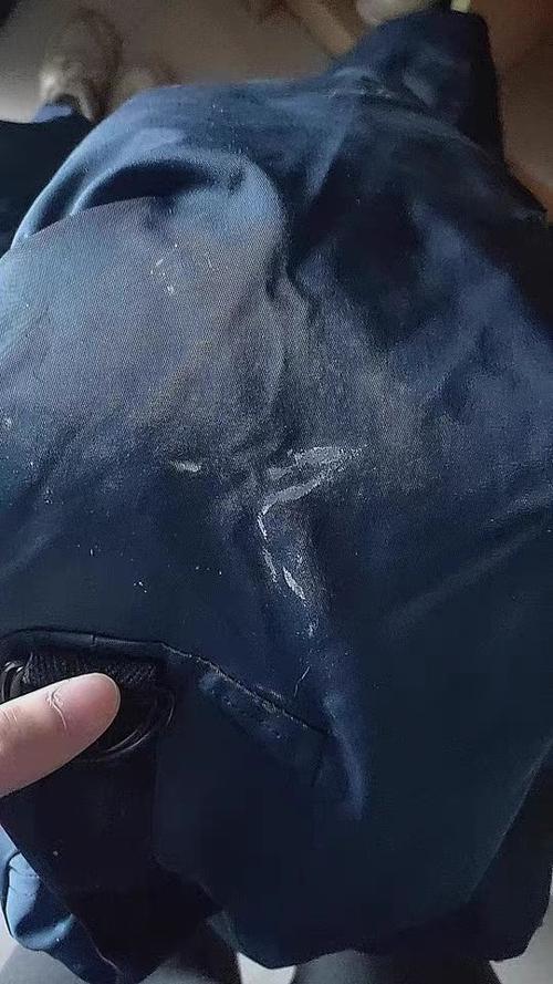 羽绒服上面有胶怎么去掉截图