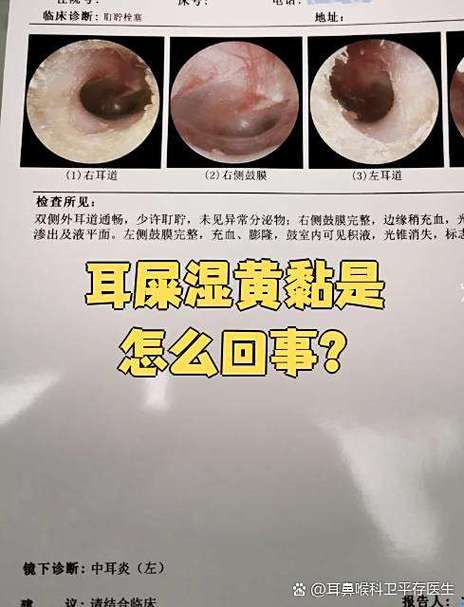 耳机线长时间不用变黏