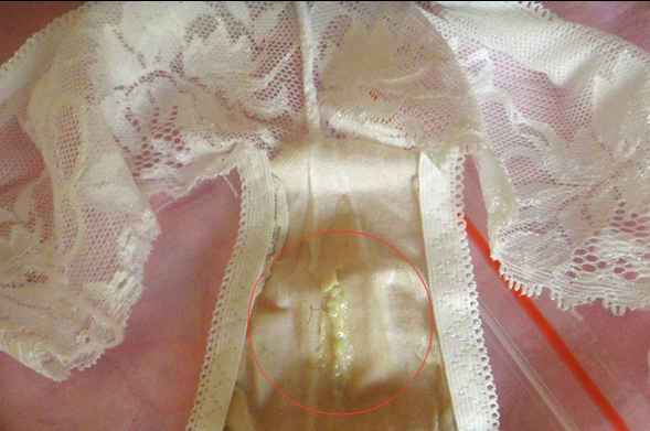为什么女生的内裤上有黏黏的分泌物截图