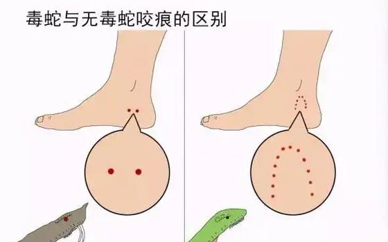 在野外遇见了毒蛇怎么办