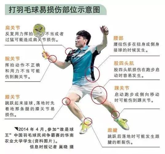 羽毛球框断了怎么办图标