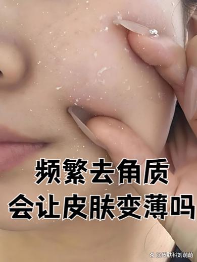 角质层薄怎么改善图标