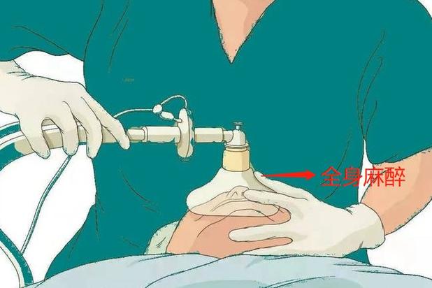 羊全身麻醉方法