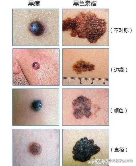 计算器电路板上的黑坨是什么图标