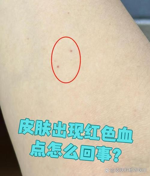 皮肤上出现红点图标