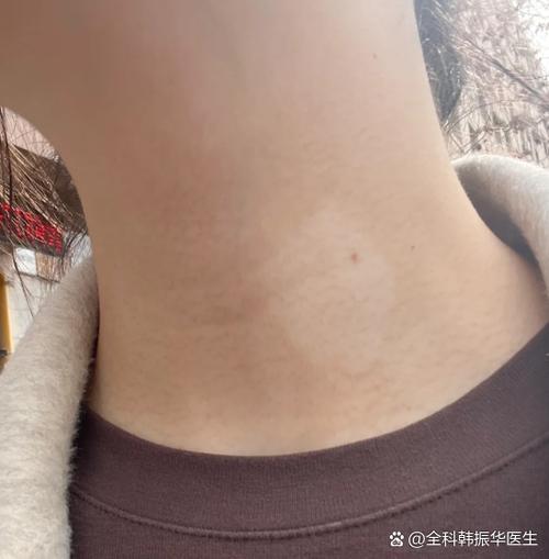 液晶电视出现白斑是什么原因图标
