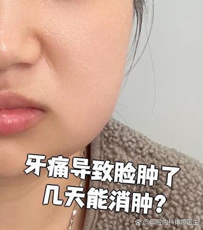 牙痛脸肿吃甲硝唑几天能消肿图标