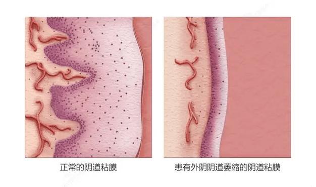怎么查看私密相册图标