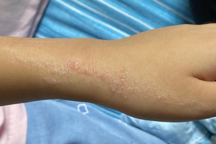 手上长像疤一样的白线图标