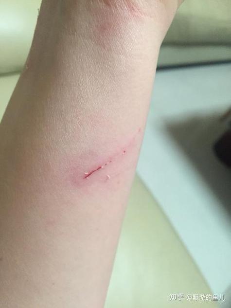 被猫爪划了一道痕