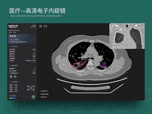 下载高清内窥镜软件图标