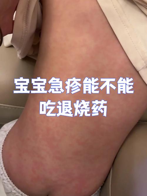 全身病毒感染症状图标