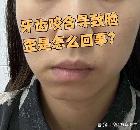 牙齿歪了导致嘴巴歪了图标