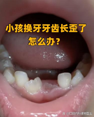 正常的牙齿长歪了要拔吗图标