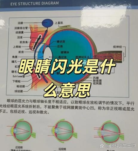 眼睛闪光是什么原因造成的图标