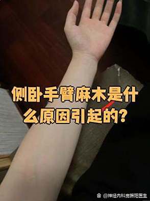 腕管综合症睡觉姿势图标